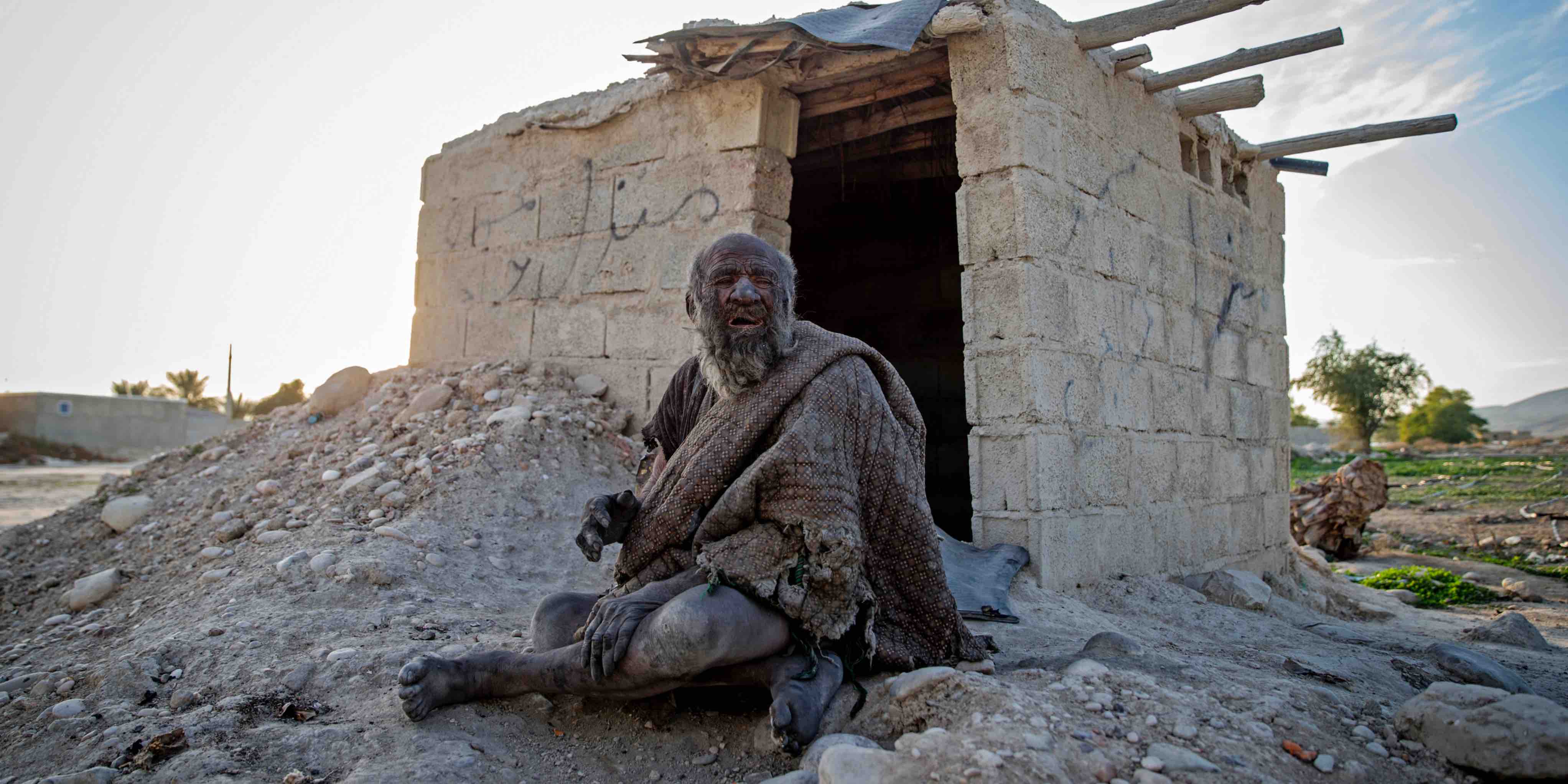 'World's dirtiest man' dies in Iran at 94: media • PhilSTAR Life