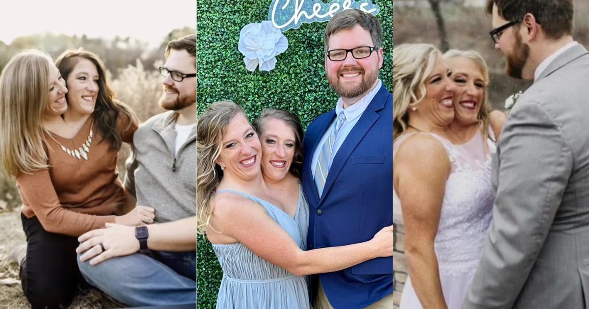 Conjoined twin Abby Hensel's husband faces paternity suit after wedding ...