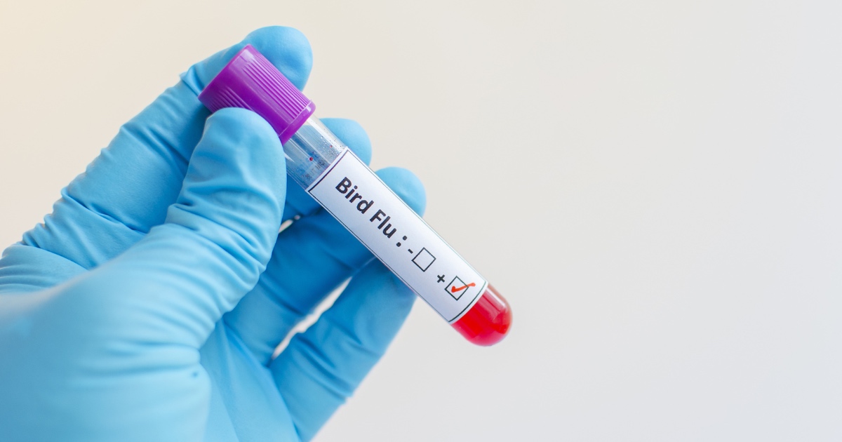 First human case of H5N2 bird flu died from multiple factors—WHO ...