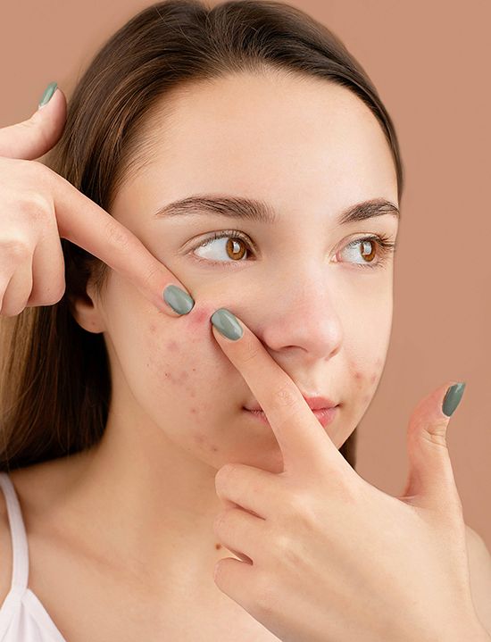 Can a pimple be life-threatening? • PhilSTAR Life