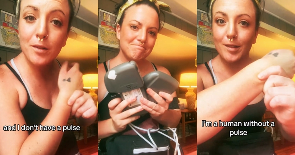 Woman with rare heart condition lives with no pulse, uses 'batteries ...