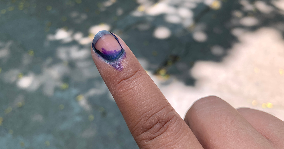 TIPS: How to get rid of indelible ink • PhilSTAR Life