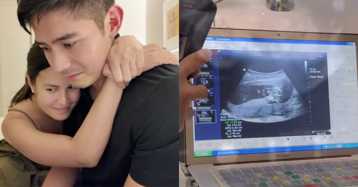 Robi Domingo, Maiqui Pineda are expecting their first baby • PhilSTAR Life