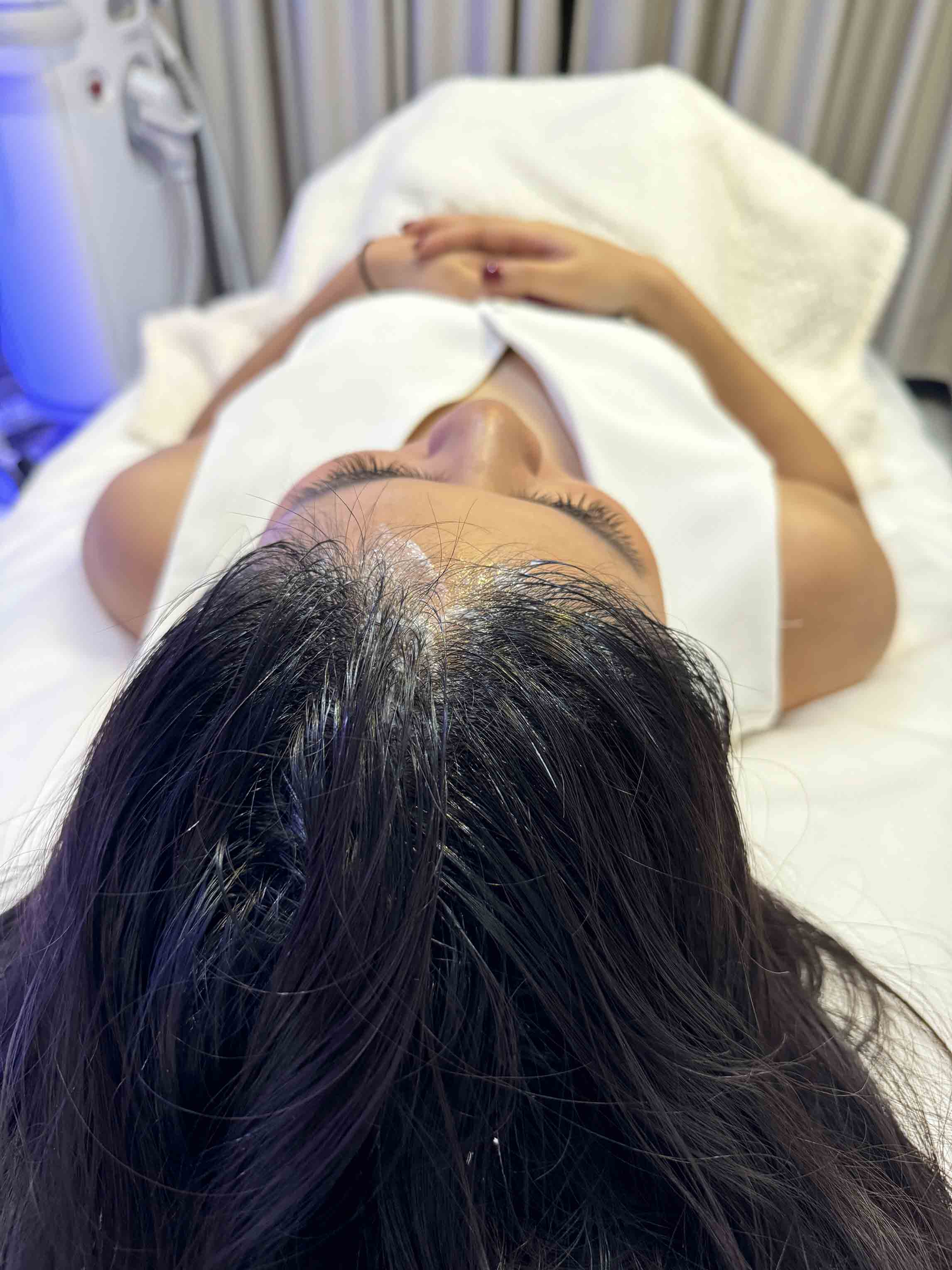 Why is my hair falling out and how do I treat it? • PhilSTAR Life