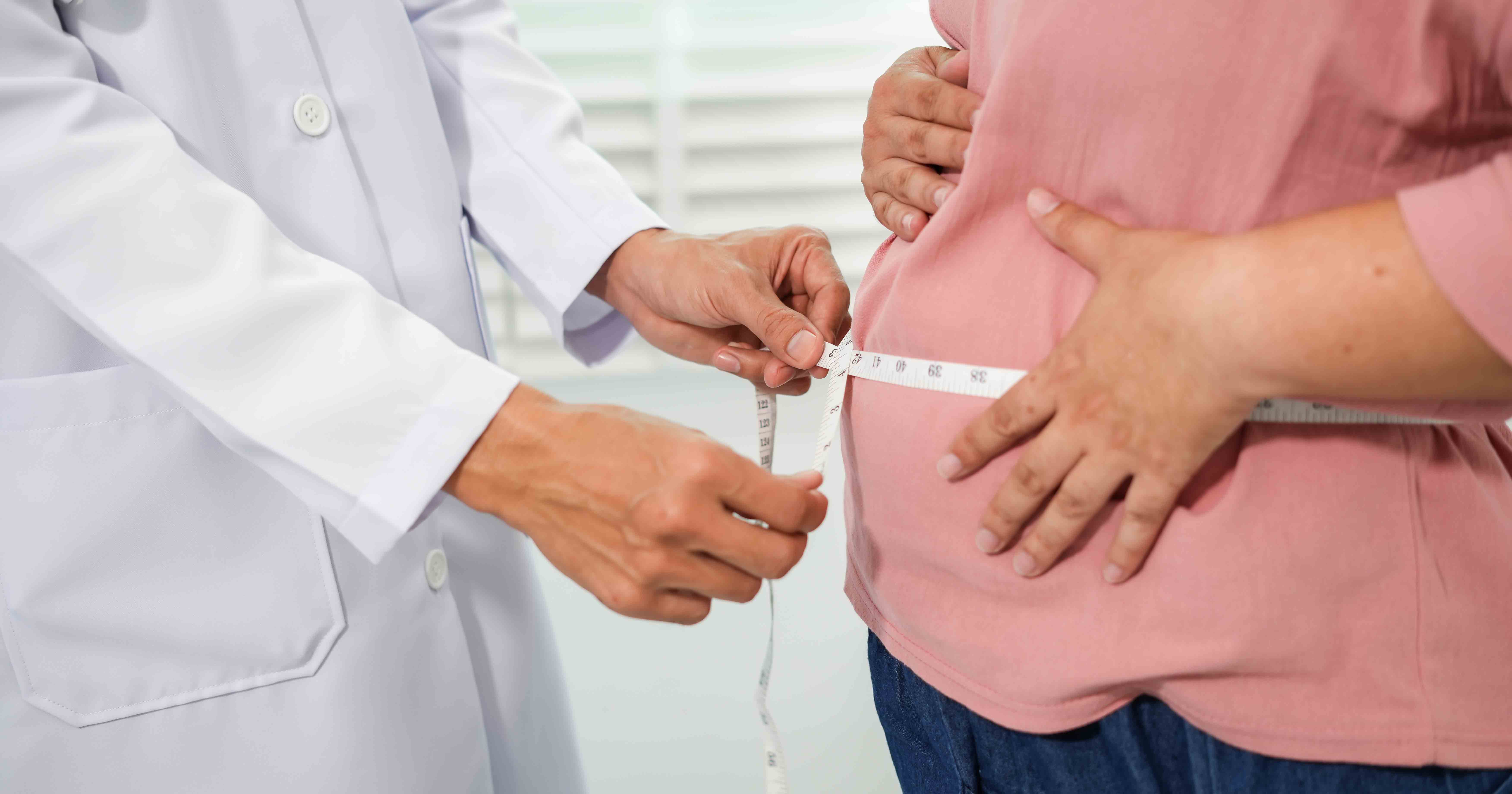 41% of Fiipinos are classified as obese—health experts • PhilSTAR Life