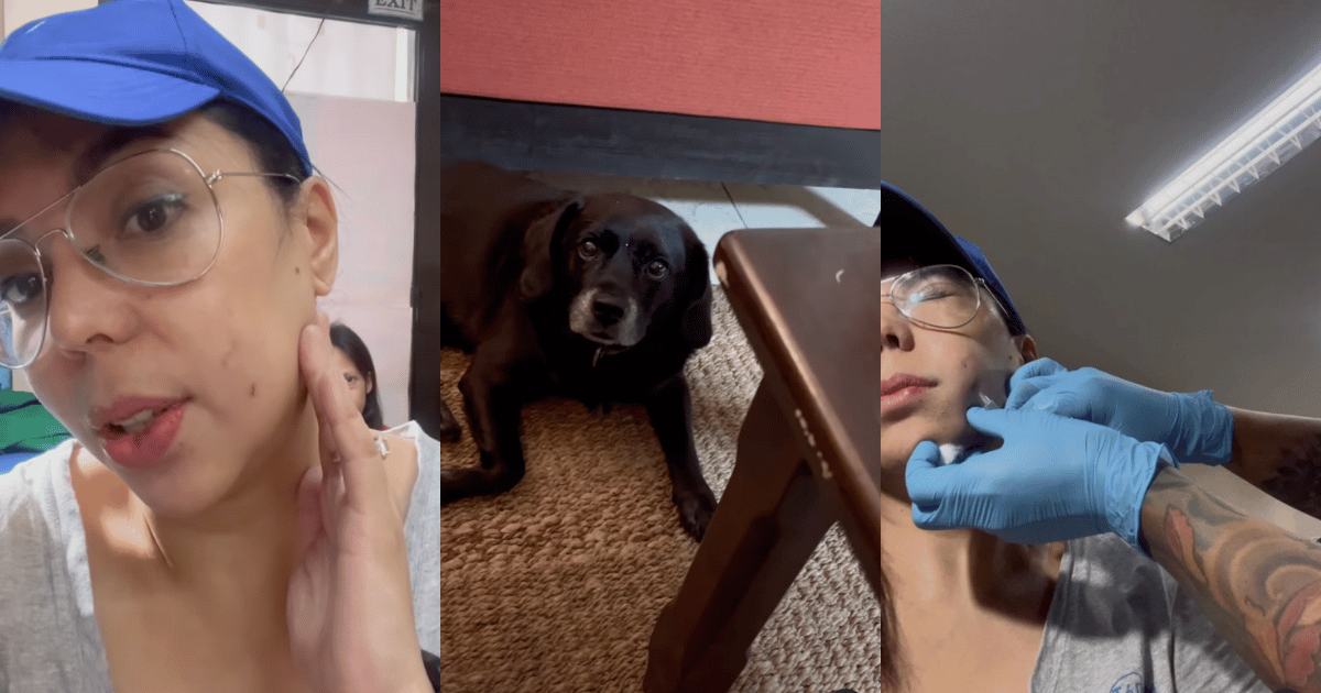 Alma Concepcion recounts dog bite incident involving her and her son ...