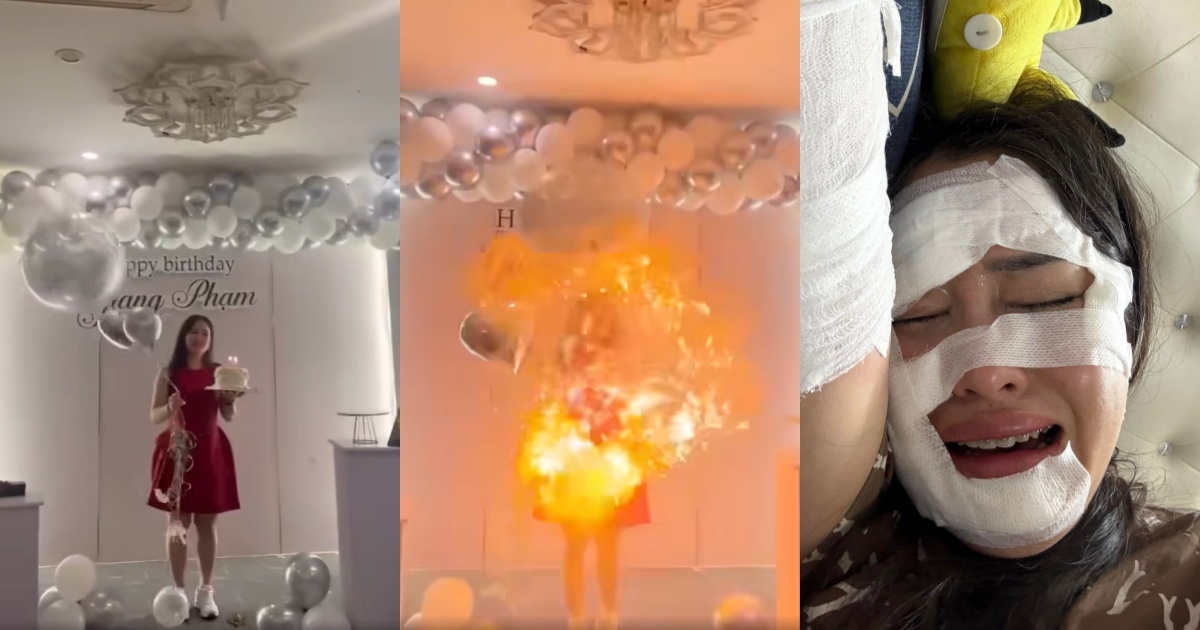 Birthday disaster: Woman suffers second-degree burns as balloons ...