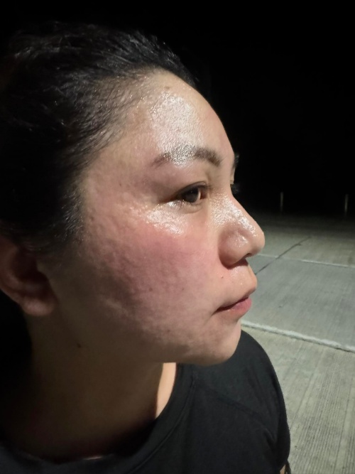 Woman who ate shrimp almost dies after a few hours during night jog ...