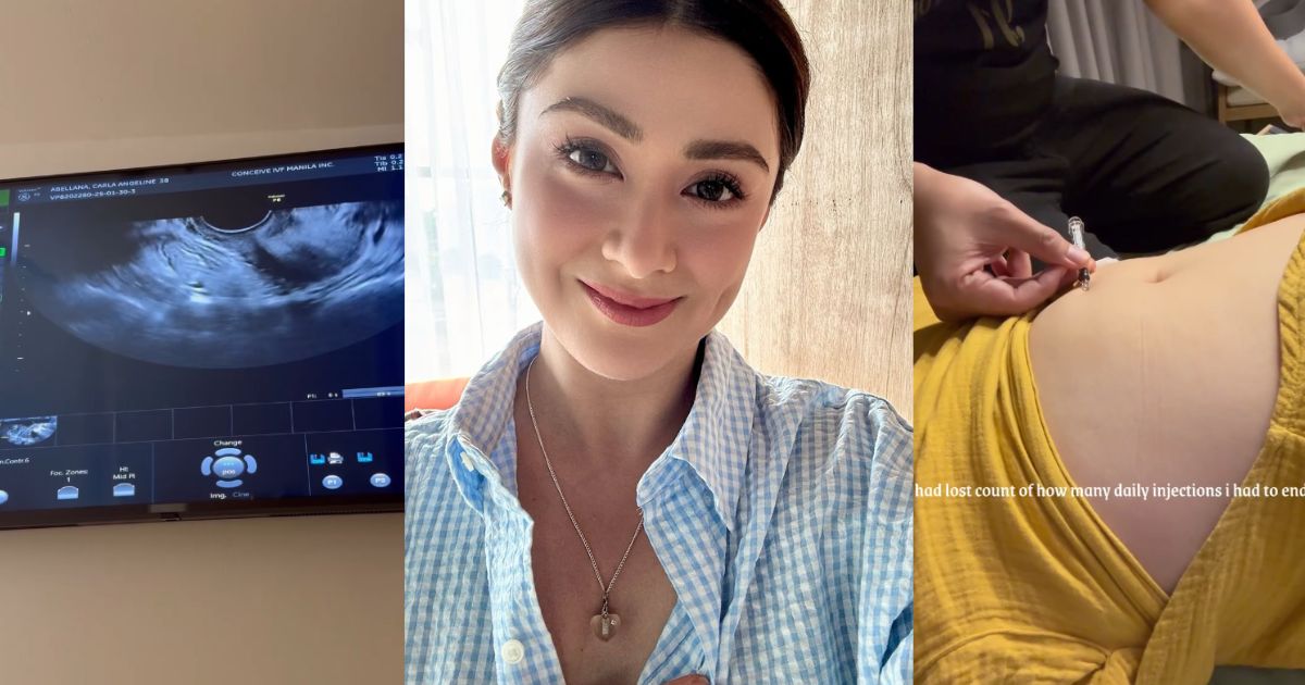 Carla Abellana opens up about 'transformative' egg freezing journey ...